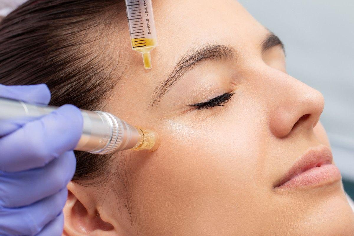 The Benefits of Plasma Skin Treatments in Worcester, MA - Dr. Gobran ...